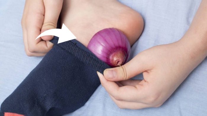 Put 1 slice of onion in your socks before going to sleep: the remedy of ...